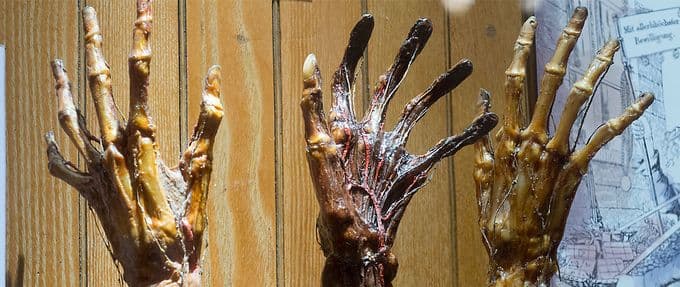 12 Creepy Exhibits at the Mütter Museum of Medical Oddities